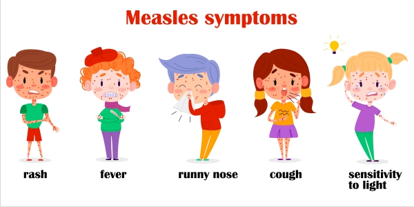 Measles